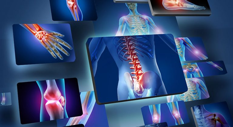 Selective Nerve Root Blocks – Specialized Pain Management